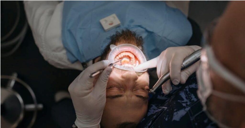 The Ultimate Guide to Wisdom Teeth Removal: What to Expect Before ...